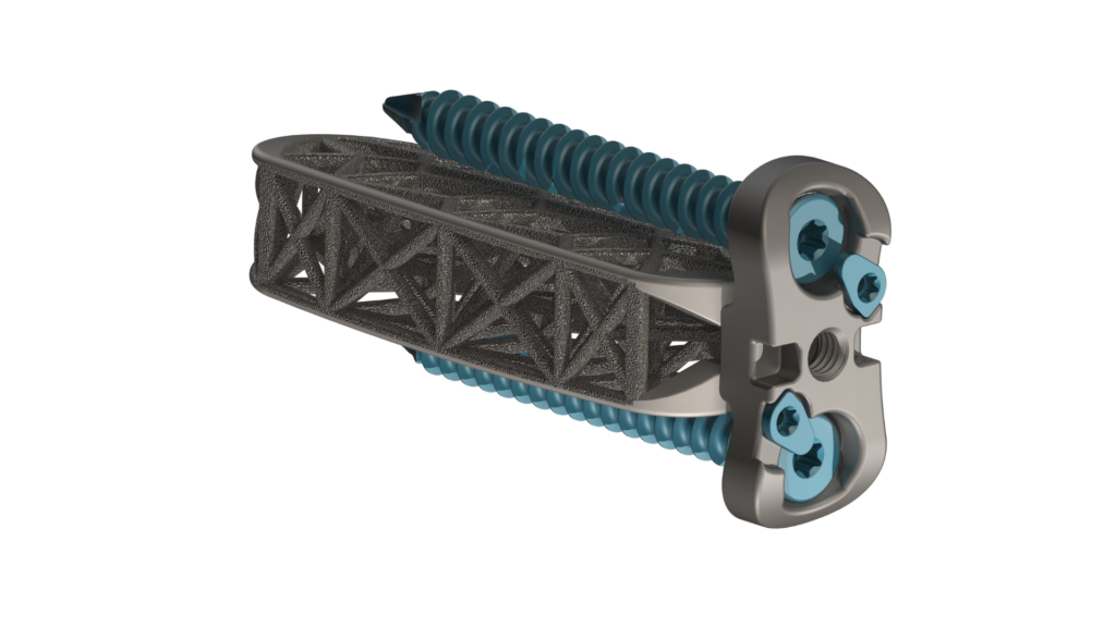 4WEB Medical Launches Hyperlordotic Lateral Implant Portfolio